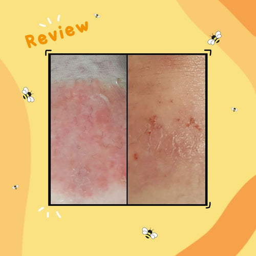 Ultra Bee Health Natural Propolis Skincare