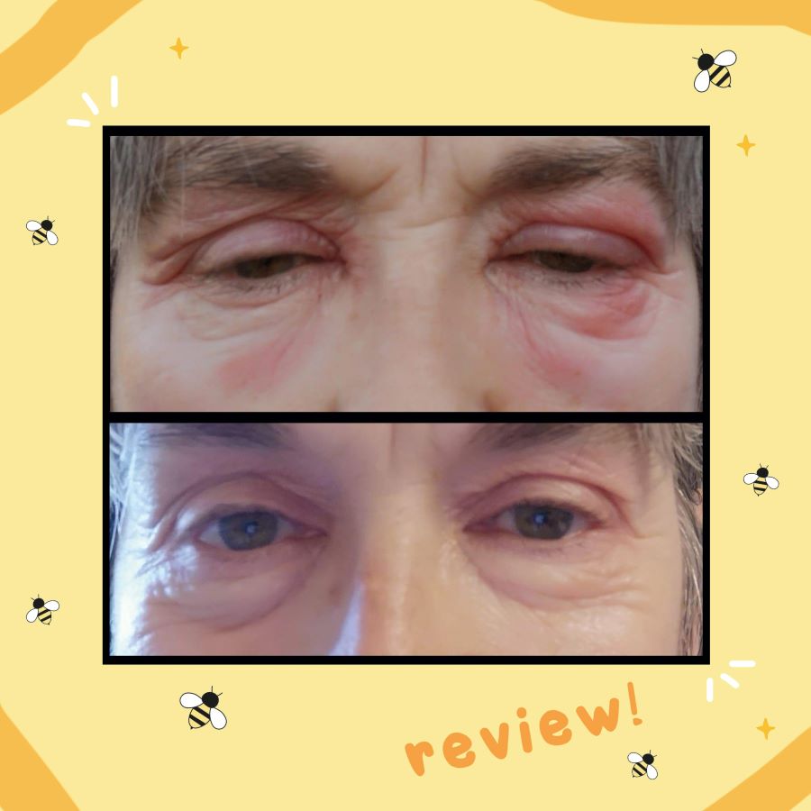 Ultra Bee Health Natural Propolis Skincare