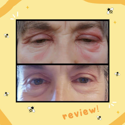 Ultra Bee Health Natural Propolis Skincare