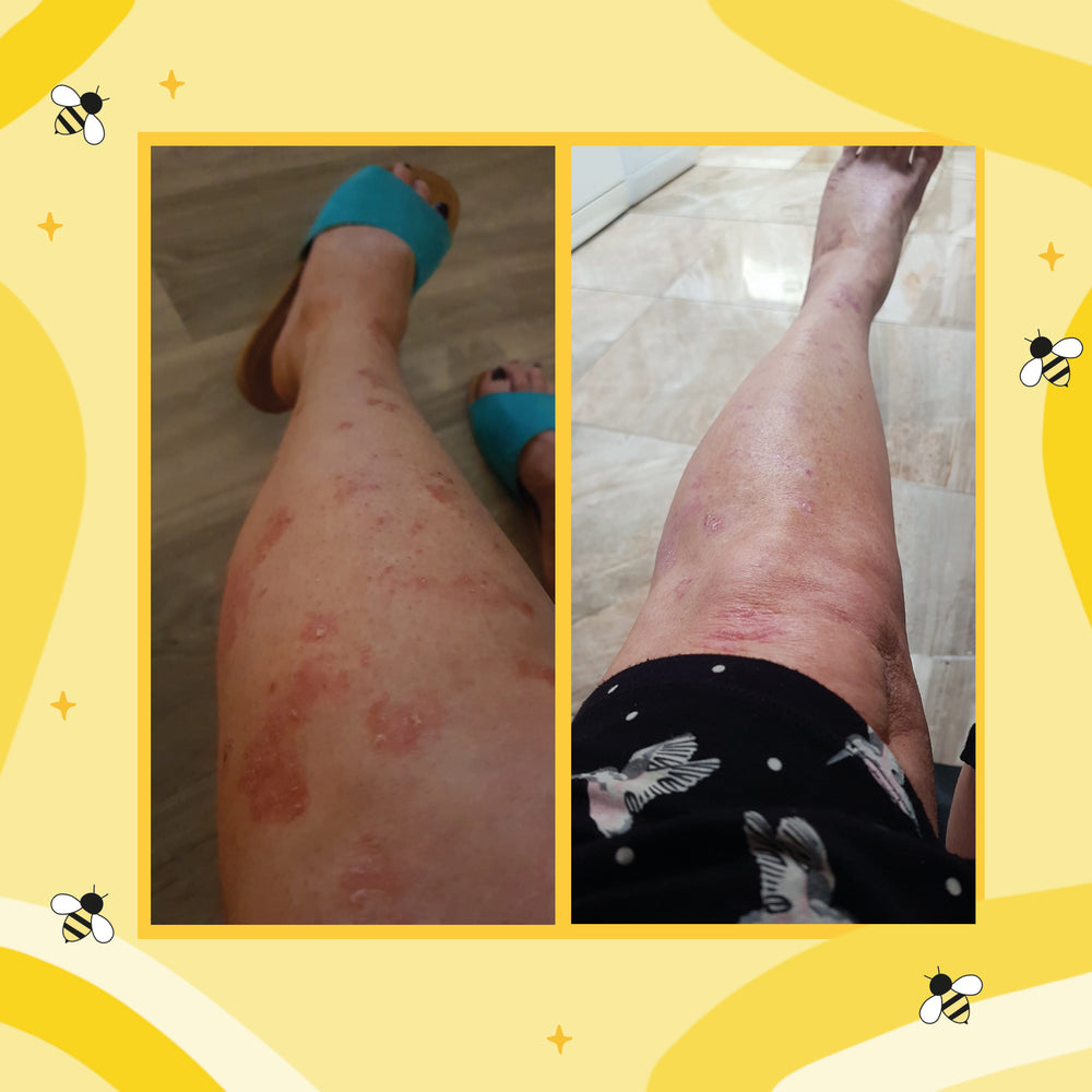 Ultra Bee Health Natural Propolis Skincare