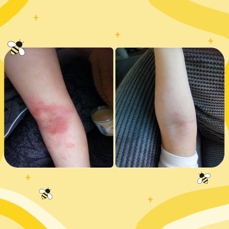 Ultra Bee Health Natural Propolis Skincare