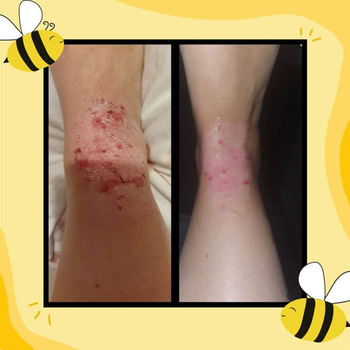 Ultra Bee Health Natural Propolis Skincare