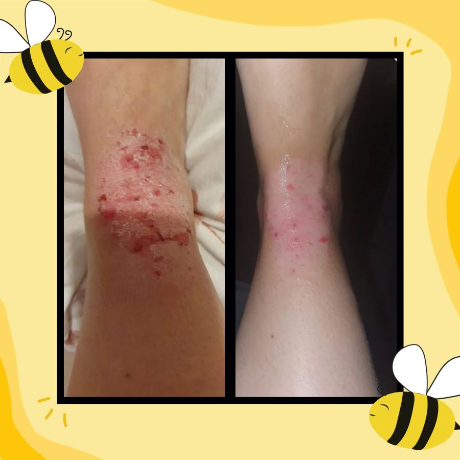 Ultra Bee Health Natural Propolis Skincare